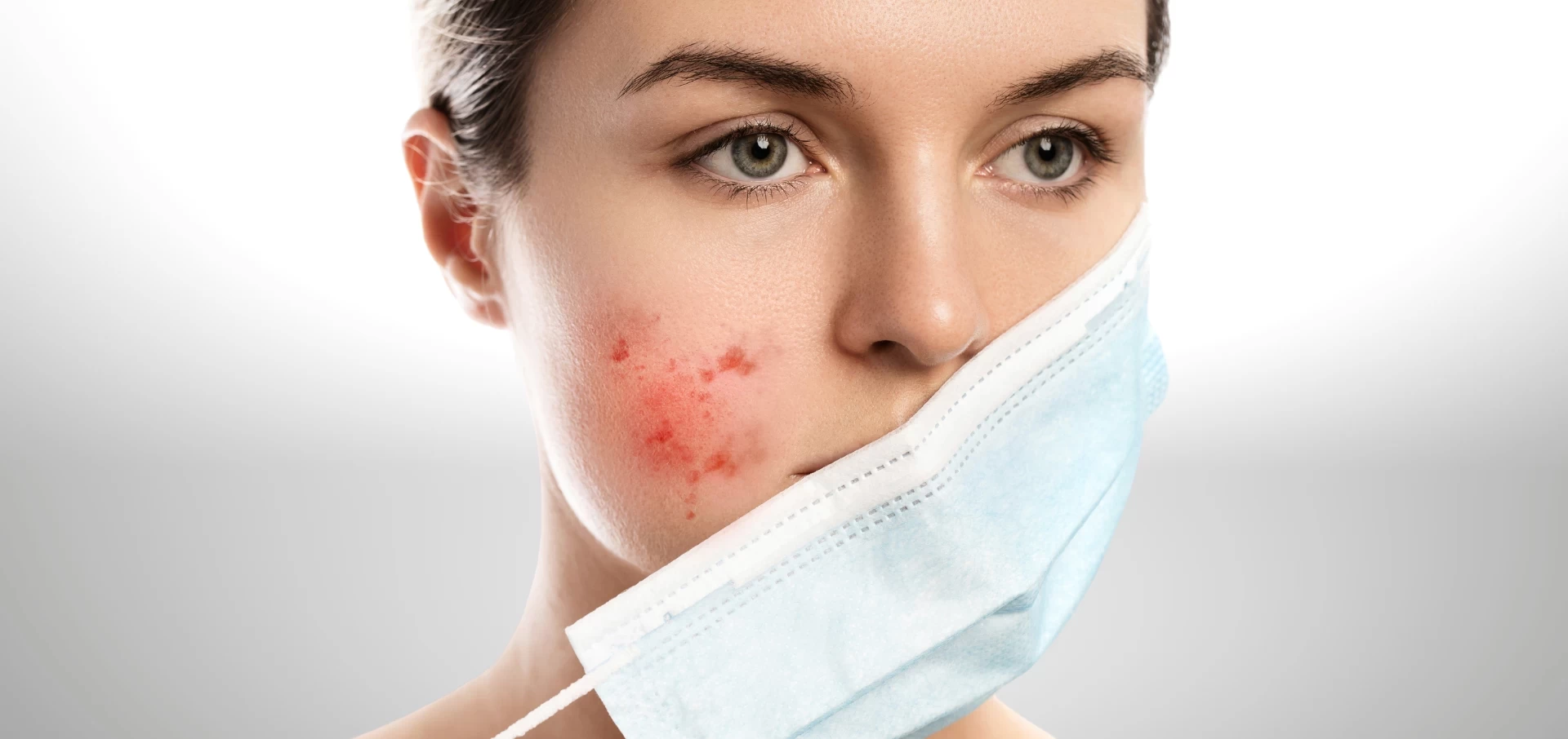 Traitement Rosacée | Traitement Couperose Prix